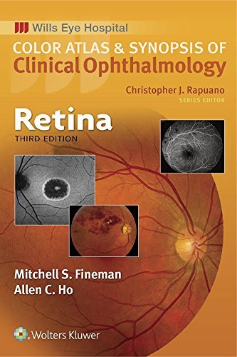 Retina by Mitchell S. Fineman | Goodreads