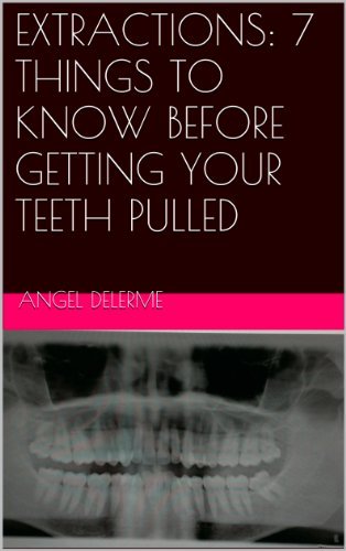 EXTRACTIONS: 7 THINGS TO KNOW BEFORE GETTING YOUR TEETH PULLED by Angel ...
