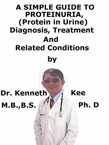 A Simple Guide To Proteinuria, (Protein in Urine) Diagnosis, Treatment ...