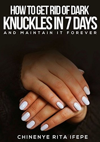 How to Get Rid of Dark Knuckles in 7 days: And Maintain it Forever by ...
