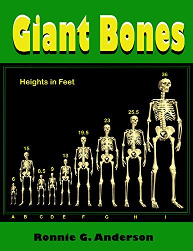 Giant Bones by Ronnie Anderson | Goodreads