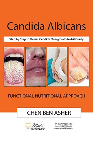 Candida Albicans: Step by Step to Defeat Candida Overgrowth ...
