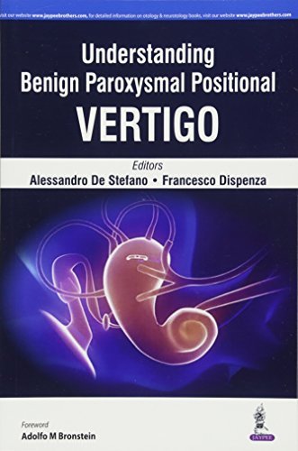Understanding Benign Paroxysmal Positional Vertigo by Adolfo M ...