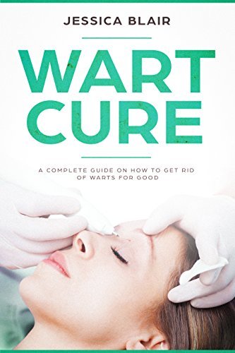 Wart Cure : A Complete Guide on How To Get Rid Of Warts For Good by ...