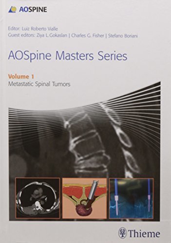 AOSpine Masters Series V1 Metastatic Spinal Tumors Indian Reprint by ...