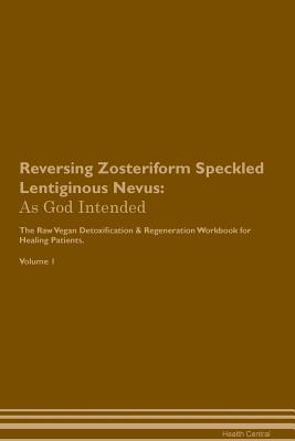 Reversing Zosteriform Speckled Lentiginous Nevus: As God Intended The ...