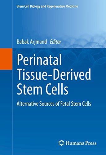 Perinatal Tissue-Derived Stem Cells: Alternative Sources of Fetal Stem ...