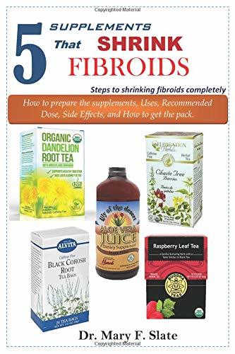 5 Supplements That Shrink Fibroids: Steps to Shrinking Fibroids ...