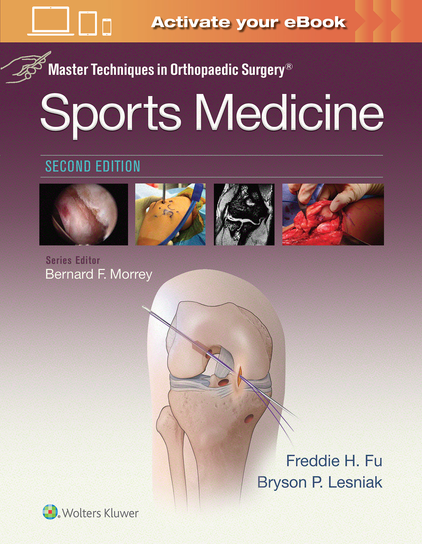 Master Techniques in Orthopaedic Surgery: Sports Medicine by Freddie H ...
