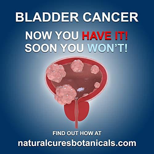 Bladder Cancer Natural Treatments: Natural Herbal Treatments for ...