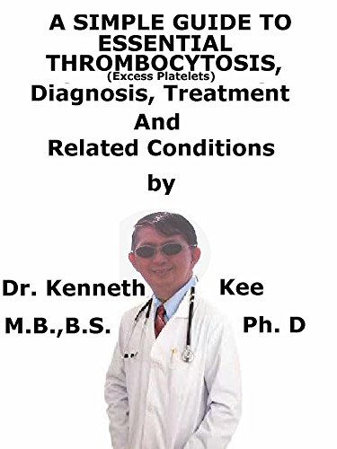 A Simple Guide To Essential Thrombocytosis, Diagnosis, Treatment And ...