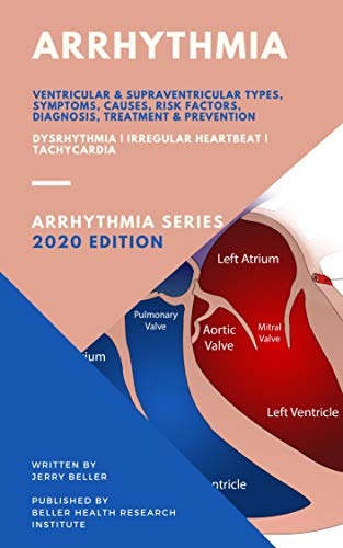 Arrhythmia: Dysrhythmia | Irregular Heartbeat | Tachycardia by Jerry ...