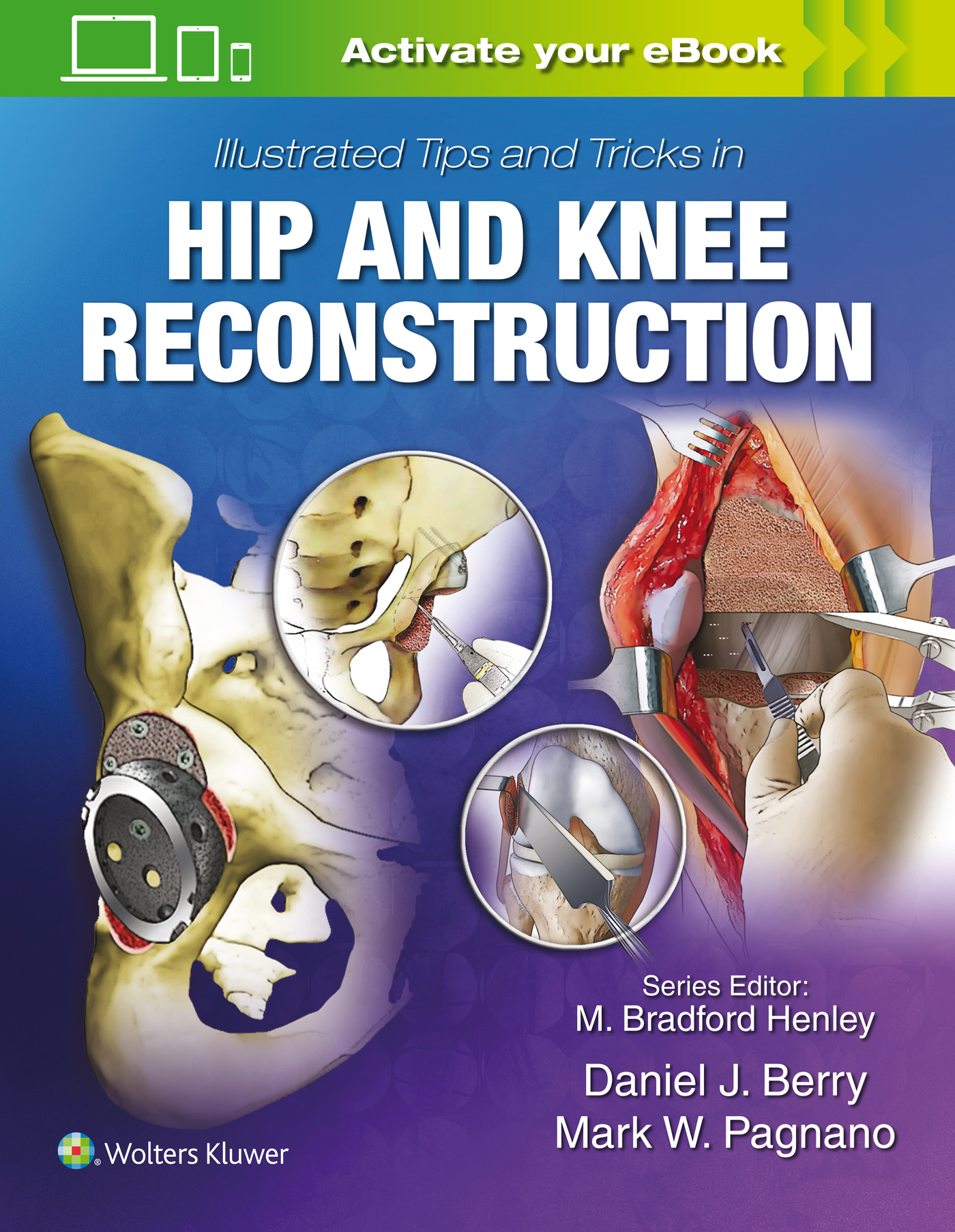 Illustrated Tips and Tricks in Hip and Knee Reconstructive and ...