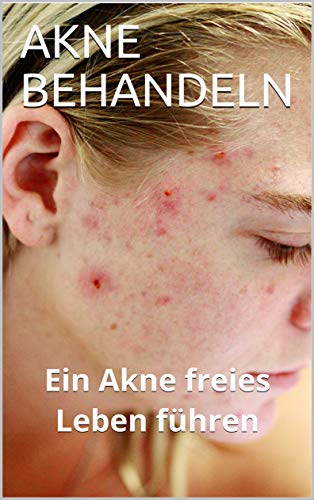 AKNE BEHANDELN: Ein Akne freies Leben führen by Jürgen Wude | Goodreads