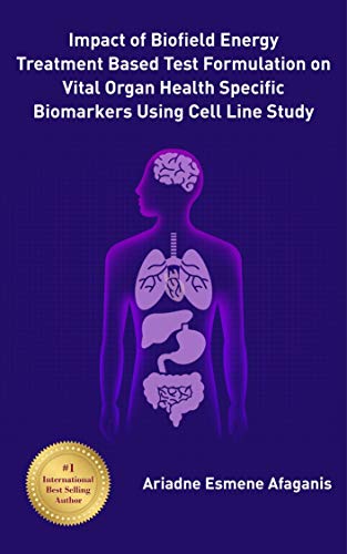 Impact of Biofield Energy Treated Based Test Formulation on Vital Organ ...