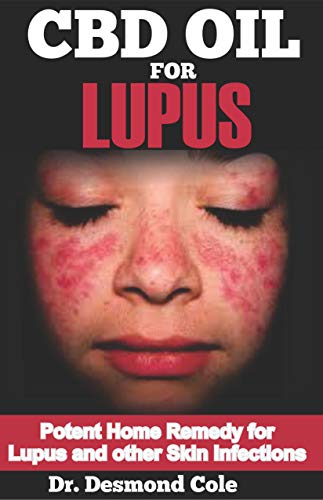 CBD OIL FOR LUPUS: Potent Home Remedy for Lupus and other Skin ...