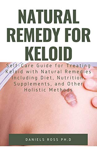 Natural Remedy for Keloid: Self-care Guide for Treating Keloid with ...