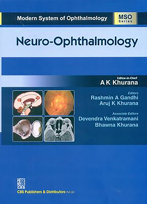 Neuro-Opthalmology (Modern System of Opthalmology) by A.K. Khurana ...