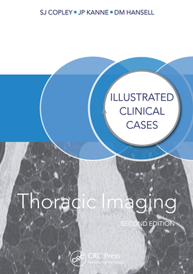 Thoracic Imaging: Illustrated Clinical Cases, Second Edition by Sue ...