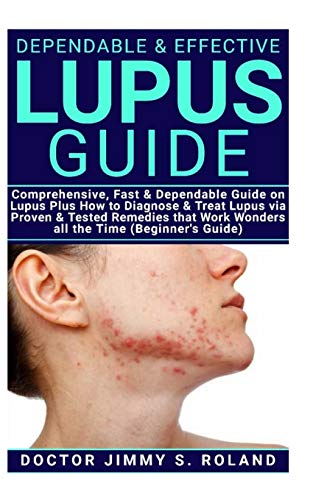 Dependable & Effective Lupus Guide: Comprehensive, Fast & Dependable ...