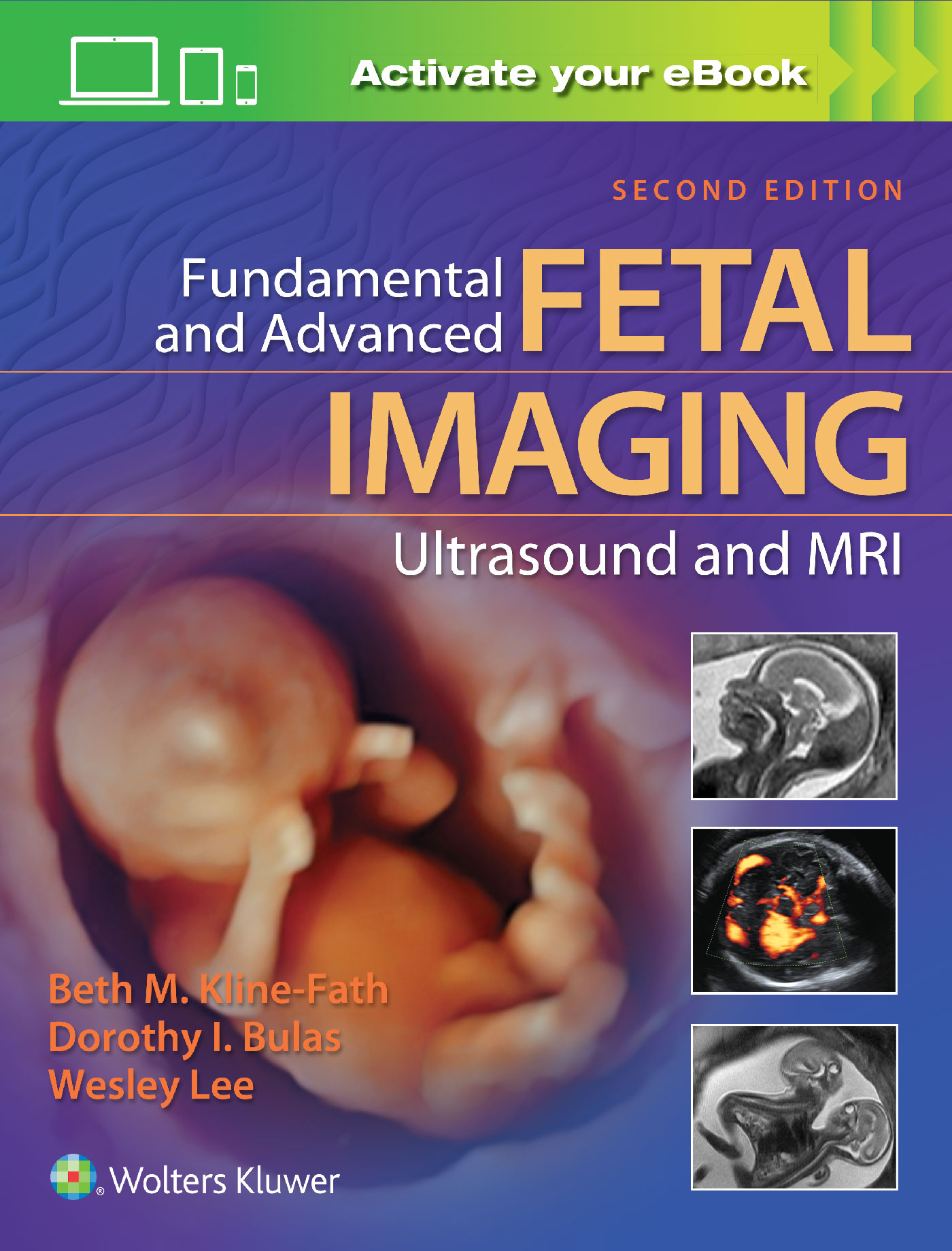 Fundamental and Advanced Fetal Imaging Ultrasound and MRI by Beth Kline ...