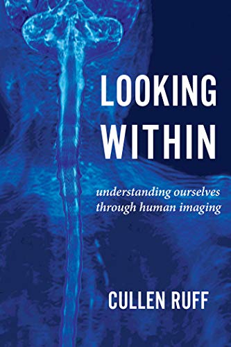 Looking Within: Understanding Ourselves through Human Imaging by Cullen ...