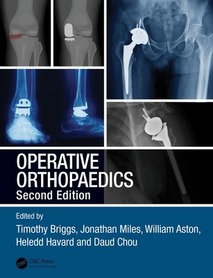 Operative Orthopaedics: The Stanmore Guide by Timothy Briggs | Goodreads