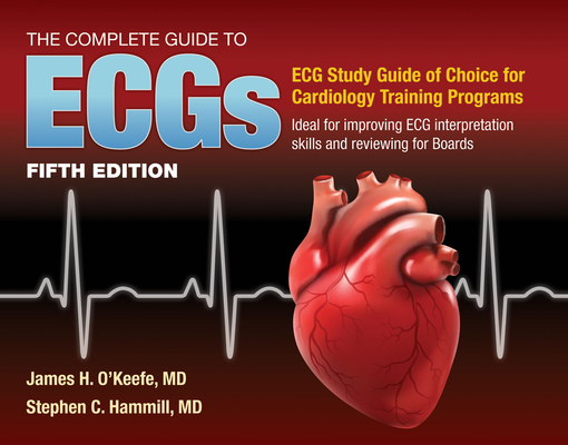 The Complete Guide to Ecgs: A Comprehensive Study Guide to Improve ECG ...