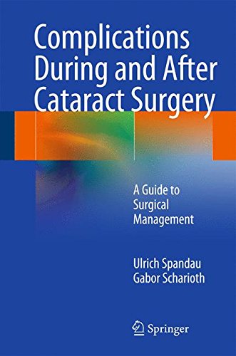 Complications During and After Cataract Surgery: A Guide to Surgical ...