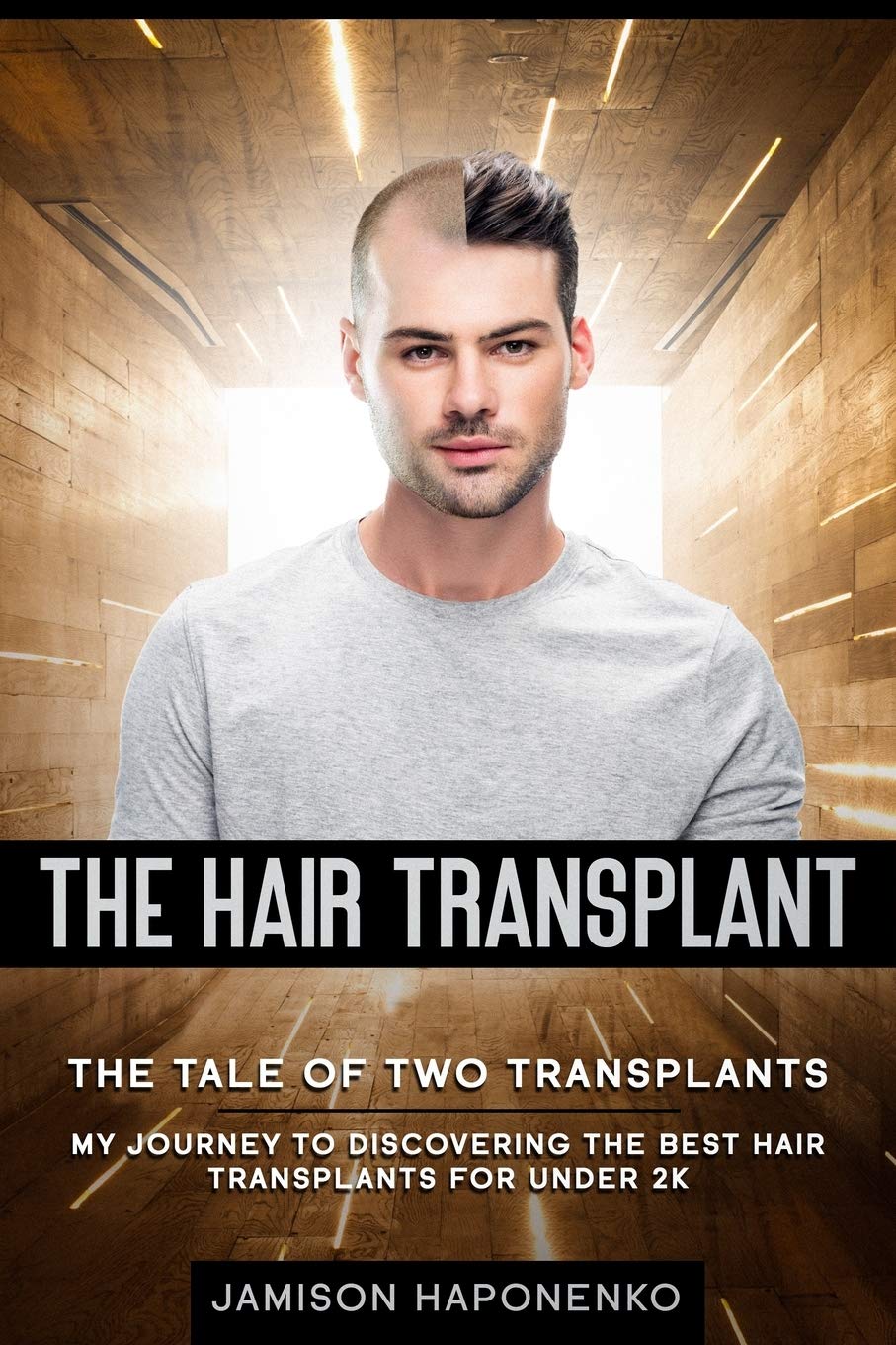 THE HAIR TRANSPLANT: The Tale of Two Transplants My Journey to ...