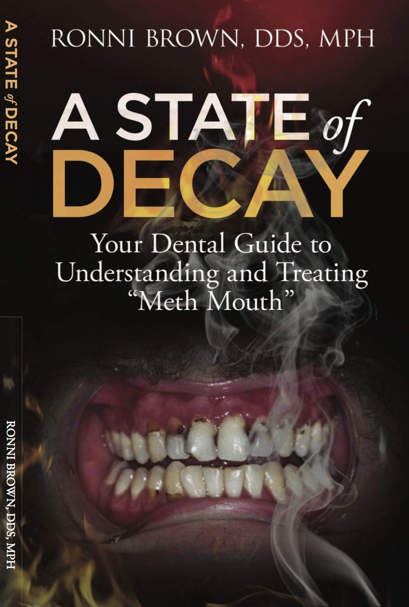 A State of Decay: Your Dental Guide to Understanding and Treating "Meth ...