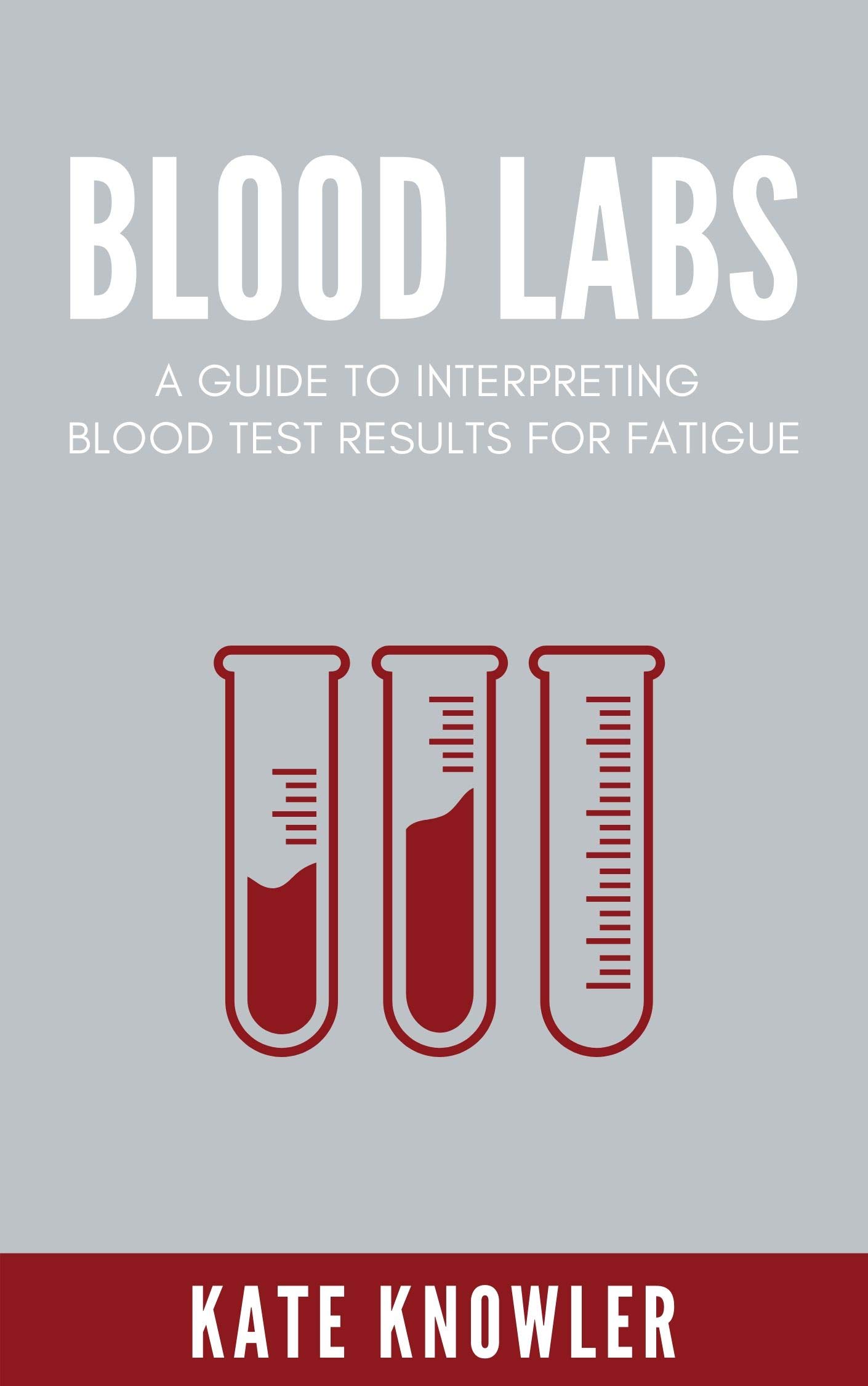 Blood Labs: A guide to interpreting blood test results for fatigue by ...