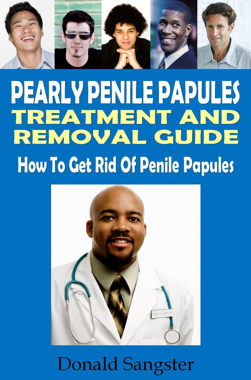 Pearly Penile Papules : Treatment And Removal Guide by Donald Sangster ...