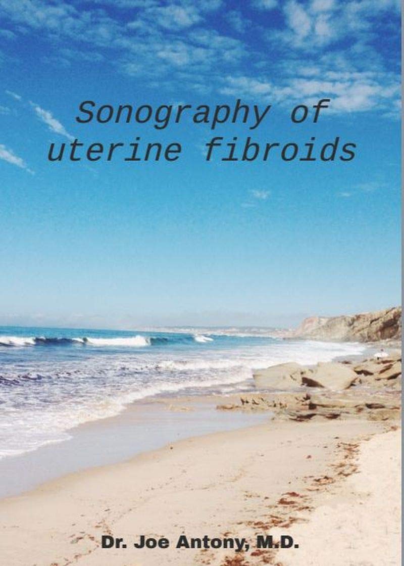 Sonography of uterine fibroids by Joe Antony | Goodreads