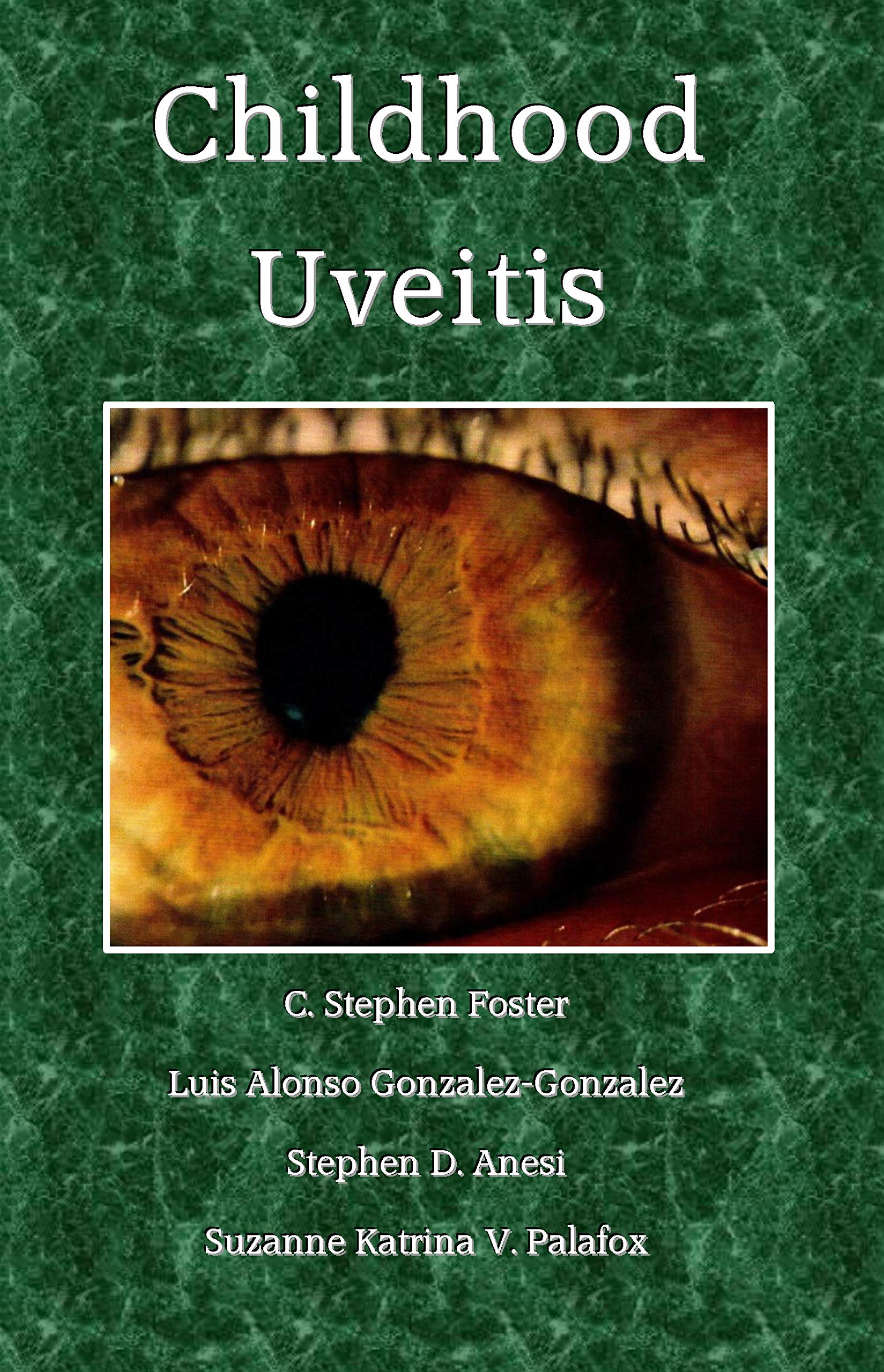 Childhood Uveitis by C. Stephen Foster | Goodreads