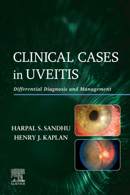Clinical Cases in Uveitis: Differential Diagnosis and Management by ...
