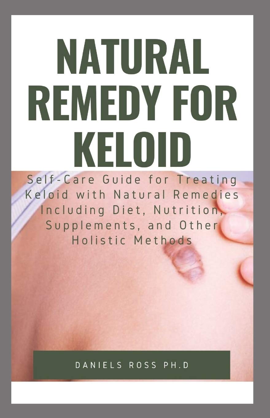 NATURAL REMEDY FOR KELOID: What Your Doctor Will Not Tell You and ...