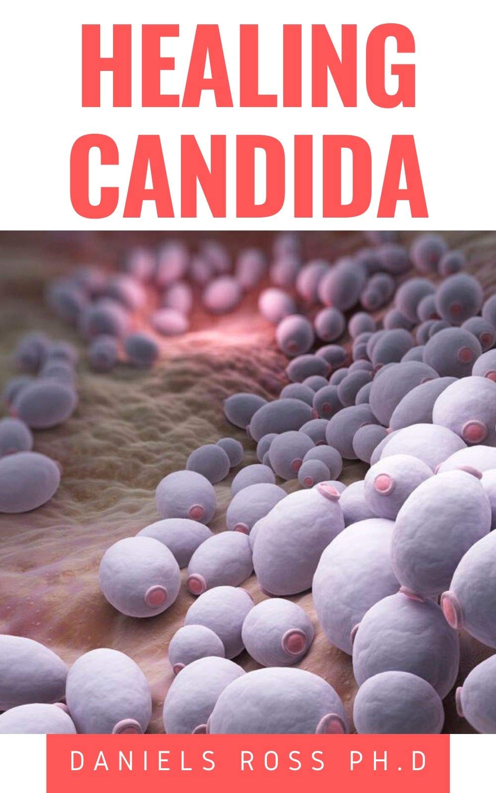 HEALING CANDIDA: Healthy,Holistic,Comprehensive,Natural Treatment ...