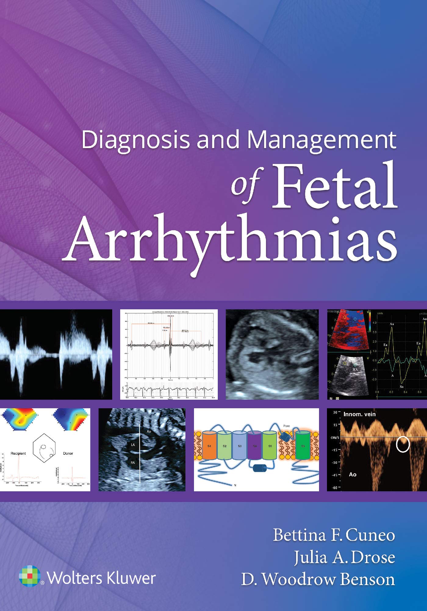 Diagnosis and Management of Fetal Arrhythmias by Bettina Cuneo | Goodreads