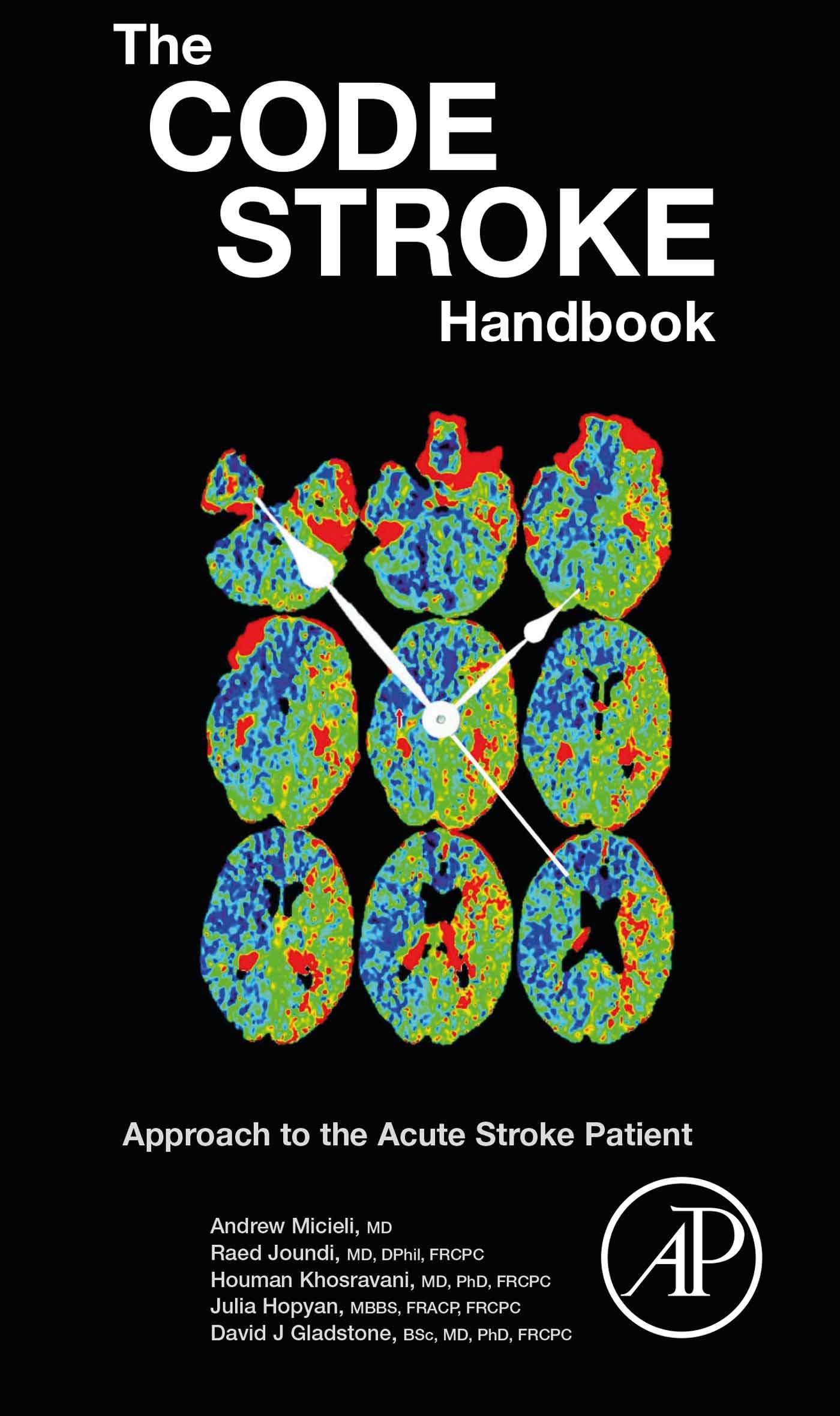 The Code Stroke Handbook: Approach to the Acute Stroke Patient by ...