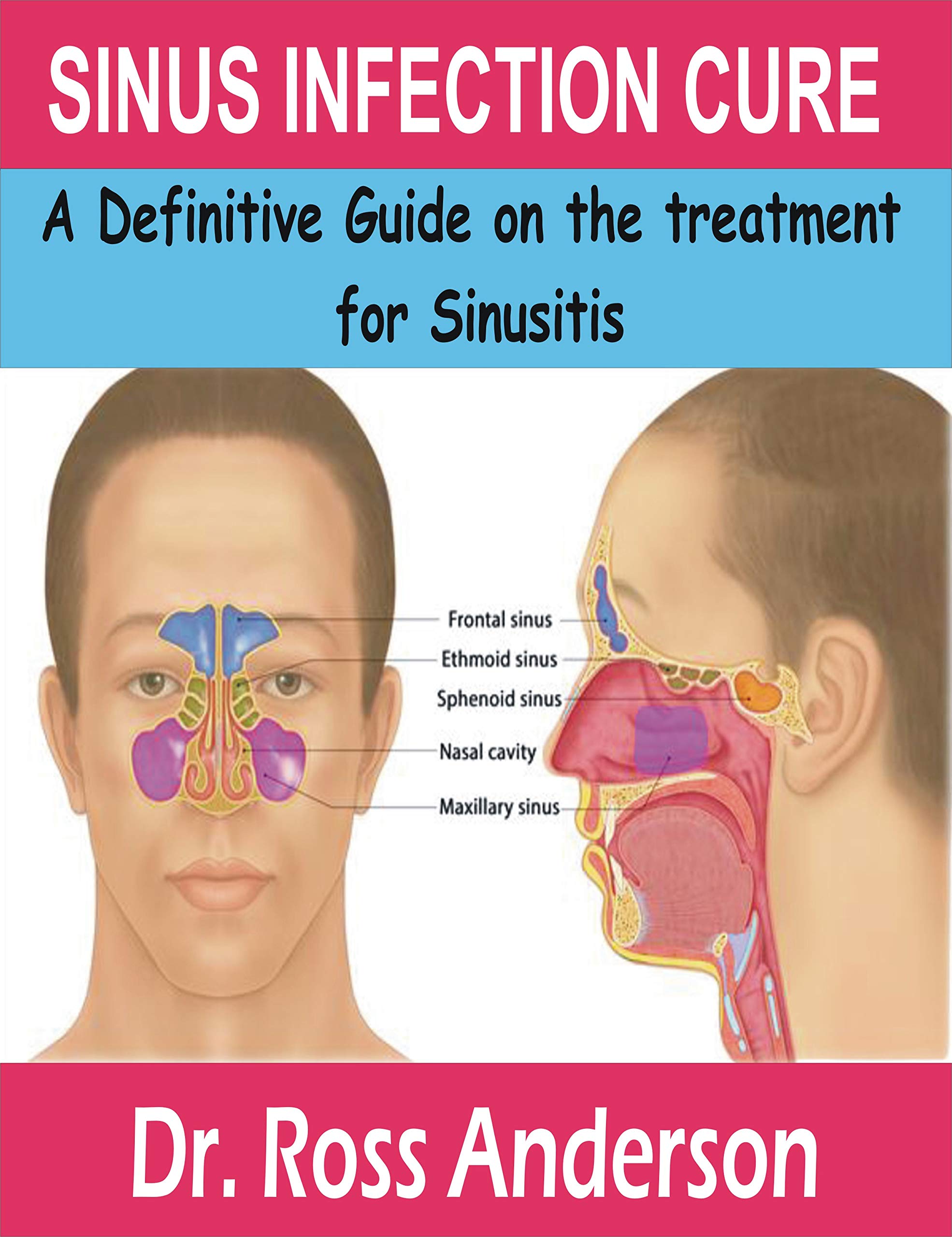 SINUS INFECTION CURE: A Definitive Guide on the treatment for Sinusitis ...