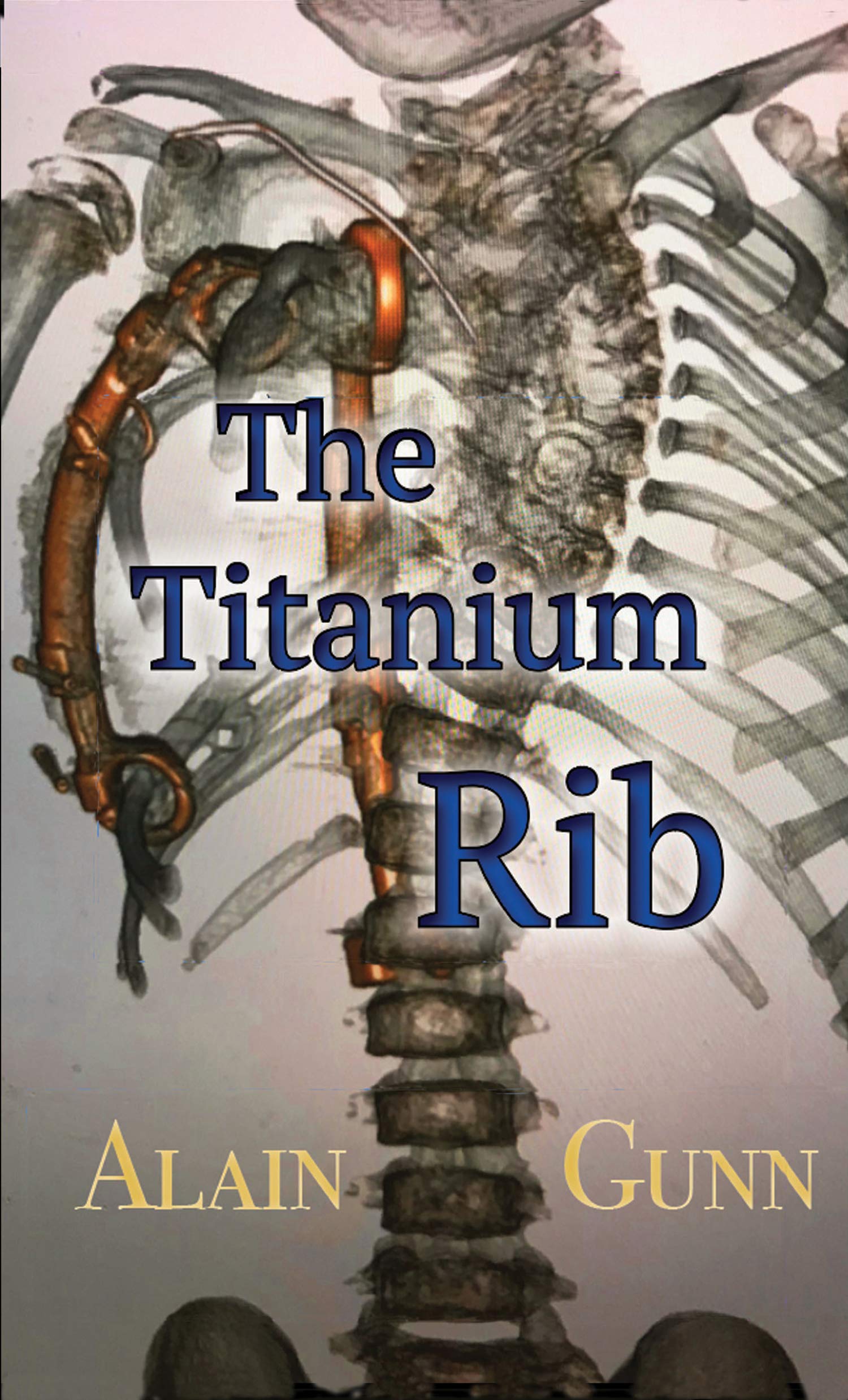 The Titanium Rib by Alain Gunn | Goodreads