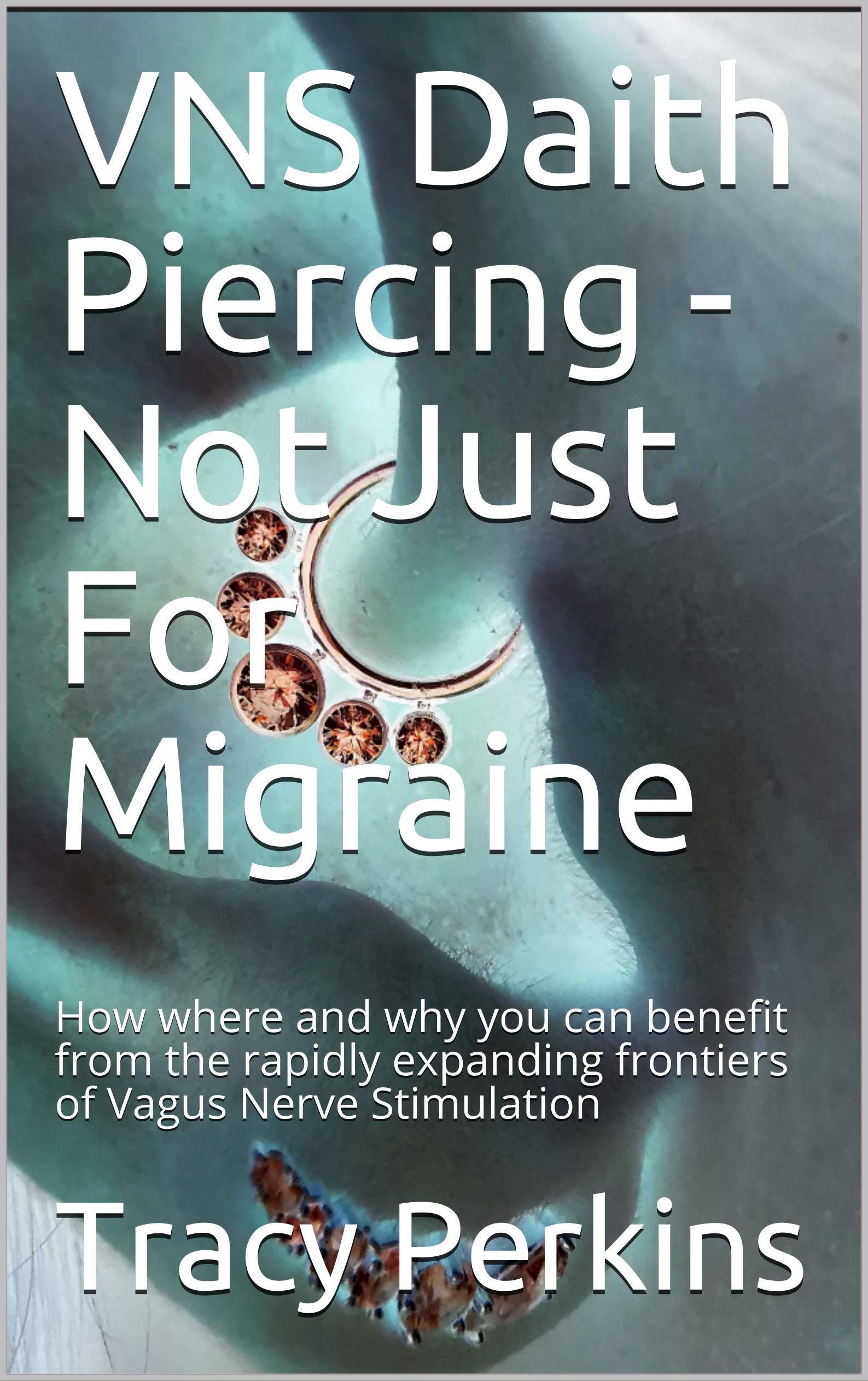 VNS Daith Piercing - Not Just For Migraine: How where and why you can ...