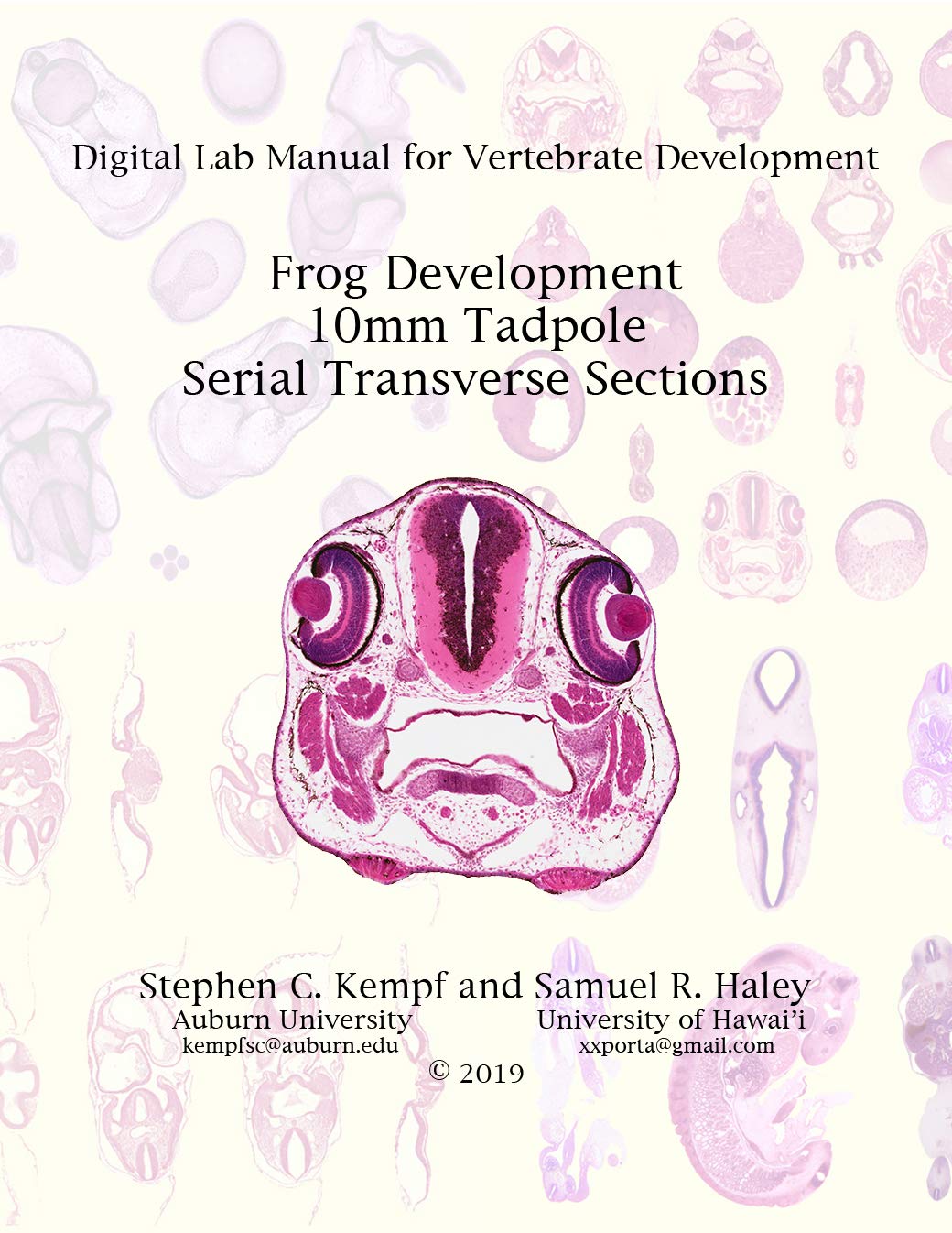 10mm Frog Tadpole Serial Transverse Sections: Digital Lab Manual for ...