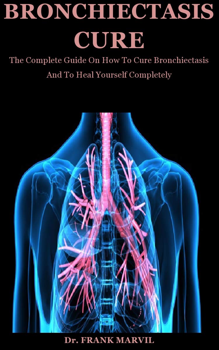 Bronchiectasis Cure: The Complete Guide On How To Cure Bronchiectasis ...
