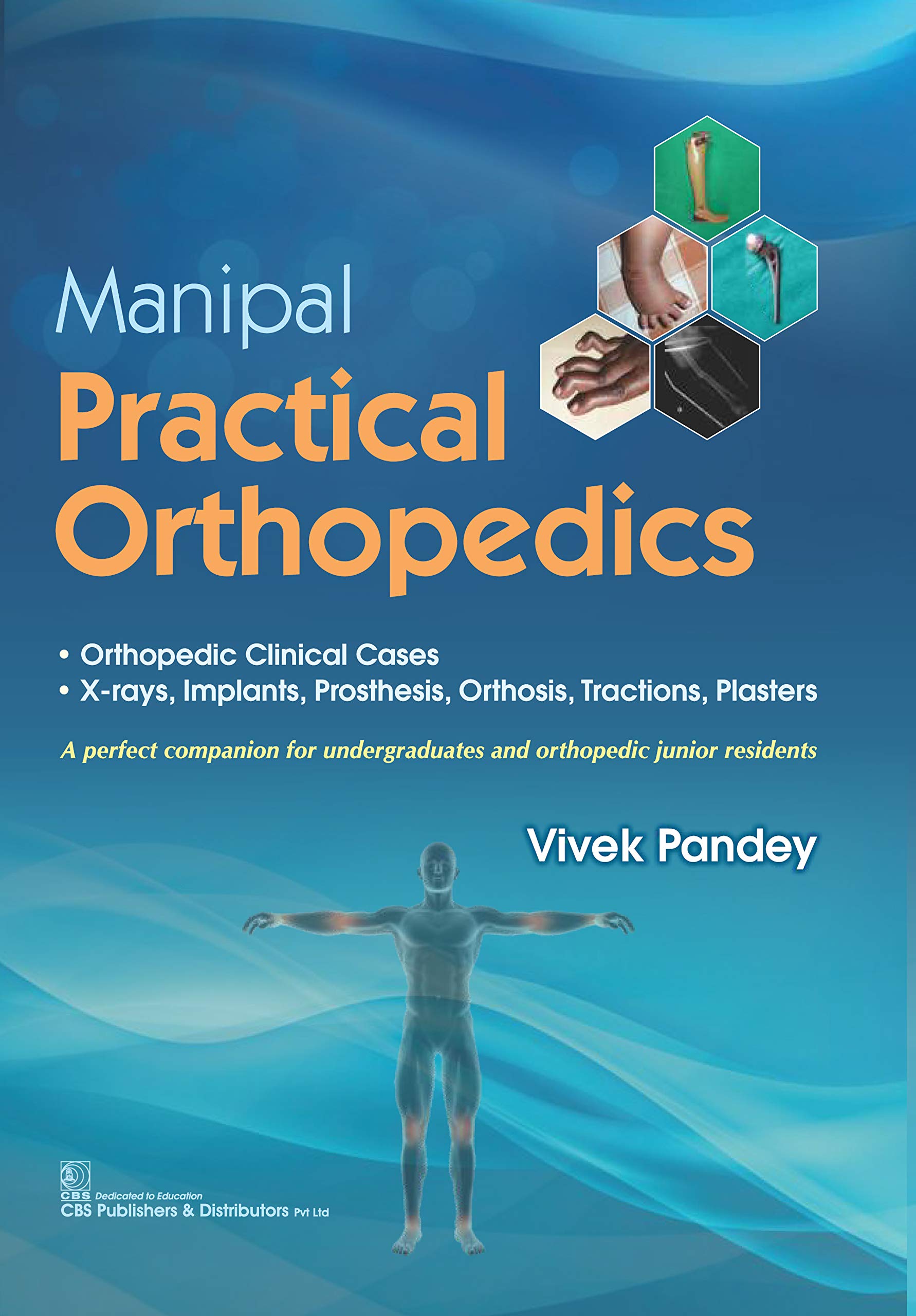 Manipal Practical Orthopaedics by Vivek Pandey | Goodreads