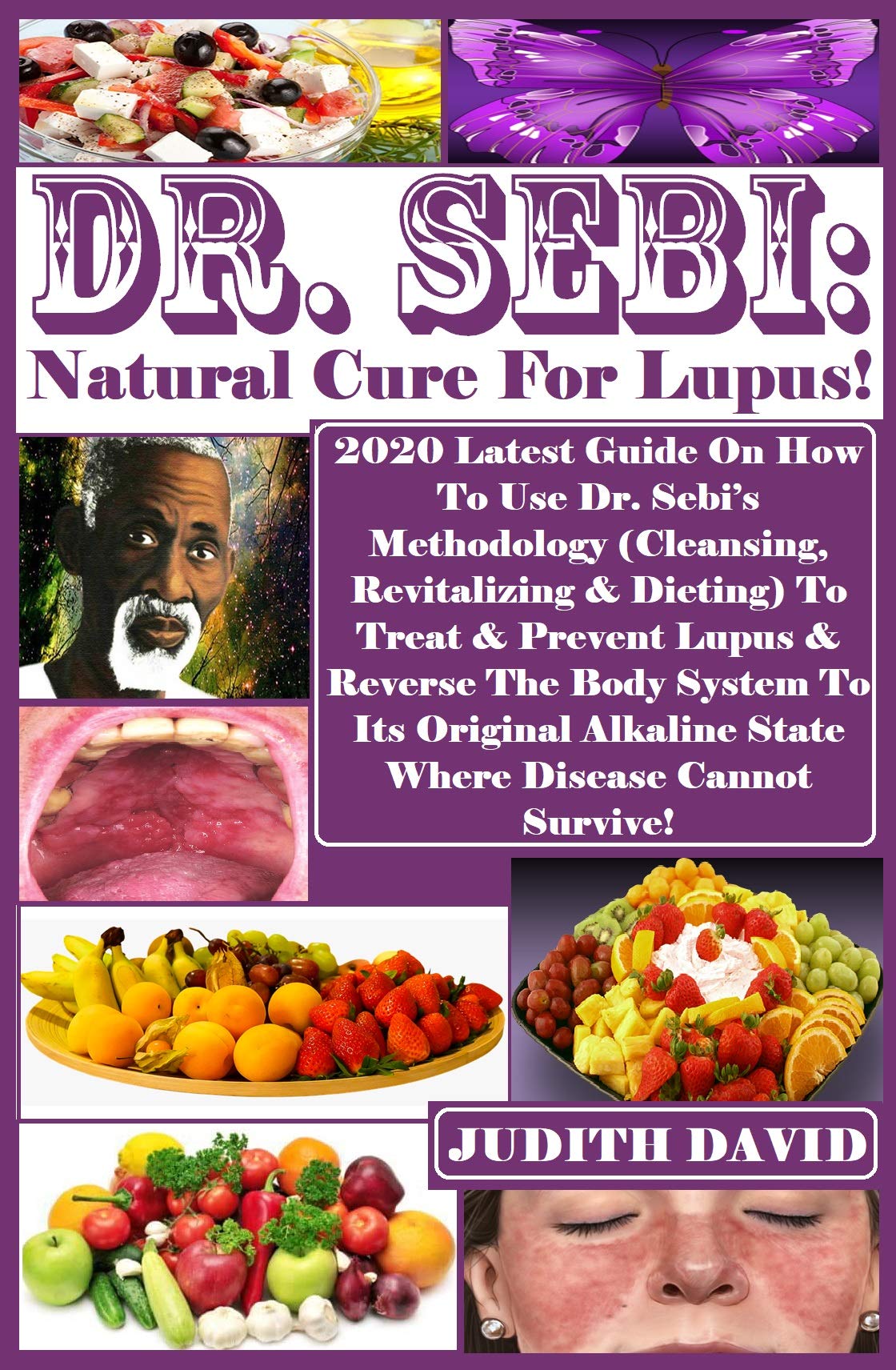 Dr. Sebi: Natural Cure For Lupus!: 2020 Latest Guide On How To Use Dr ...