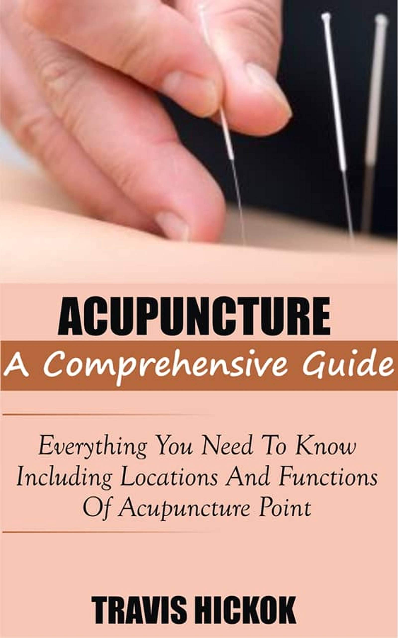ACUPUNCTURE: A Comprehensive Guide Everything You Need To Know ...