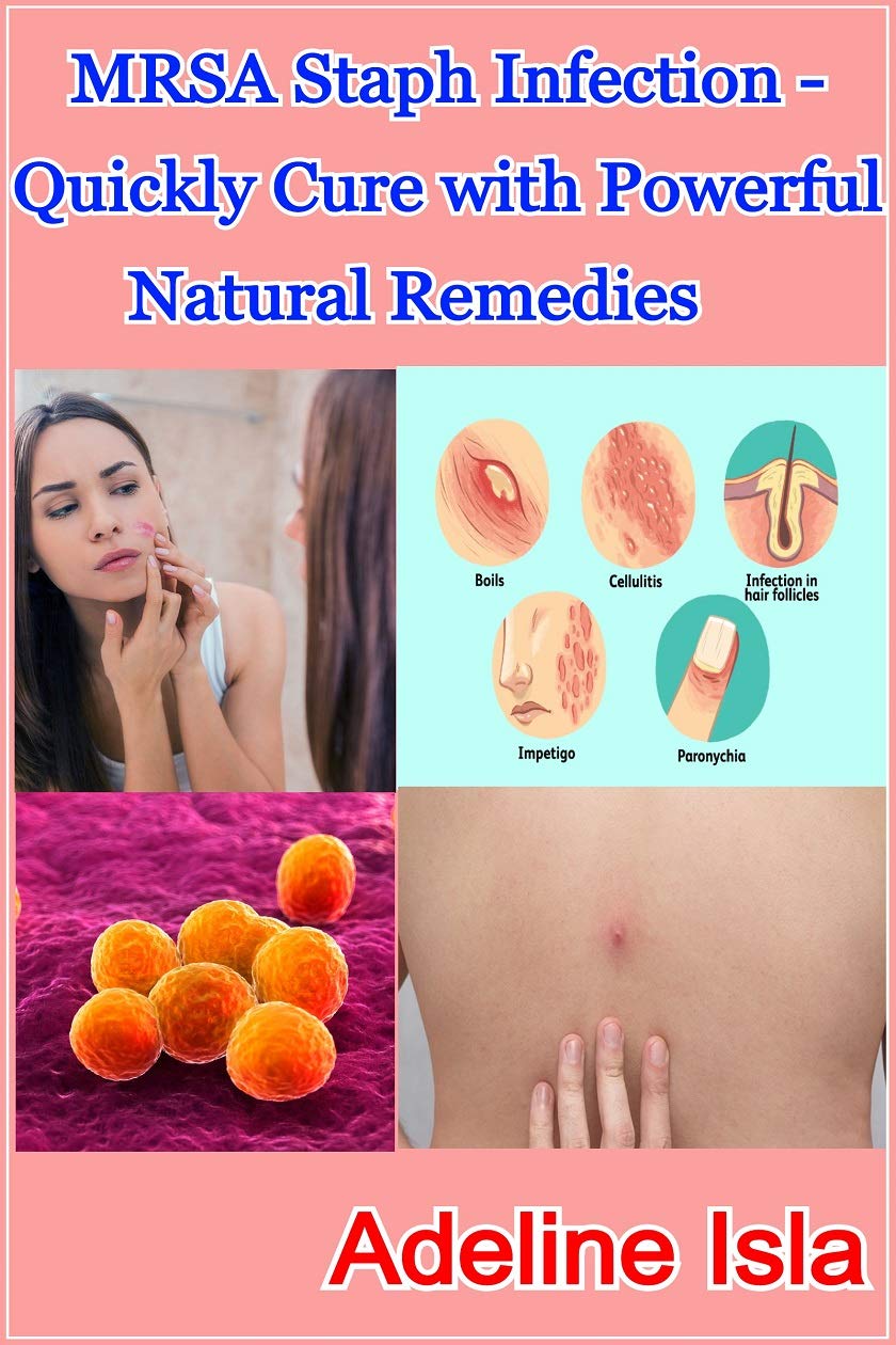 Mild Staph Infection