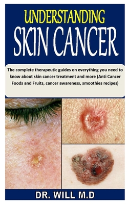 Understanding Skin Cancer: The complete therapeutic guides on ...